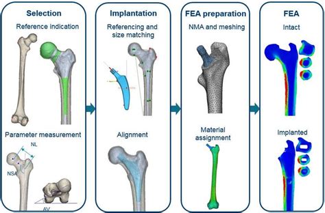 Finite Element Analysis Of Bone Scaffold 53 Download Scientific