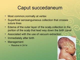 212 Birth Head Trauma Ppt