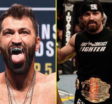 Andrei Arlovski Broken Jaw