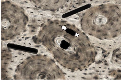 Compact Bone Lab Diagram Quizlet