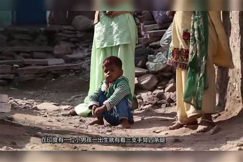 印度妇女生下“4手4脚儿童”村民们将其当成怪物，经常投掷石子怪物村民生下