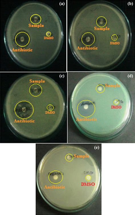 Antibacterial Potential Of Chitosan Against Ae Coli Bv Cholera Cs