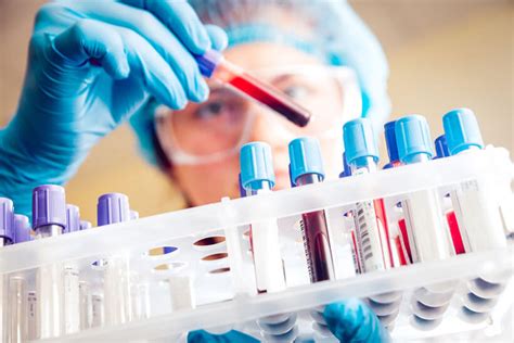 Best Std Testing Panels Of 2019 Updated Nov 2019