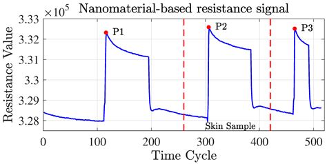 Nanomaterial Based Sensor Array Signal Processing And Tuberculosis Classification Using Machine