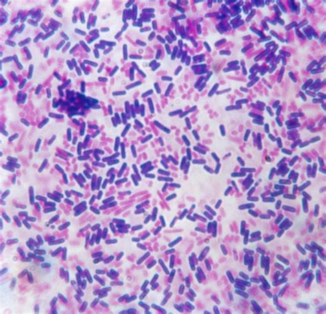 Gram Positive Stain Results At Tayla Currey Blog