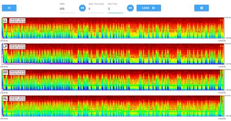 GitHub Joshblum Eeg Toolkit Some Tools For Analyzing EEG Data