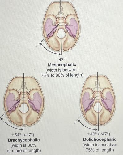 Skull Considerations And Positioning Flashcards Quizlet