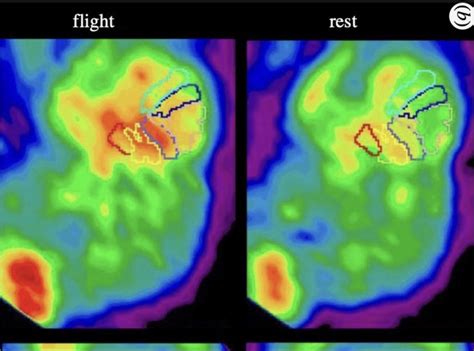 How Did The Brains Of Birds Evolve To Enable Them To Fly