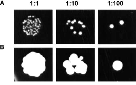 Functional Complementation Of A Yeast Mutant Deficient In Allantoin Uptake Download