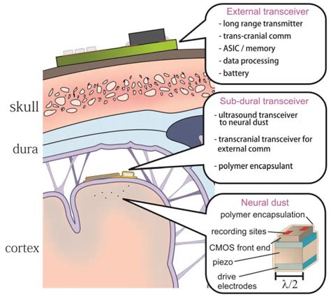 ‘neural Dust Brain Implants Could Revolutionize Brain Machine Interfaces And Allow Large Scale