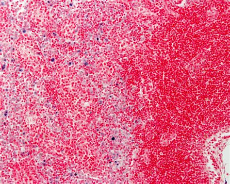 Lymph Node Macrophages Light Micrograph Stock Image C057 3918 Science Photo Library