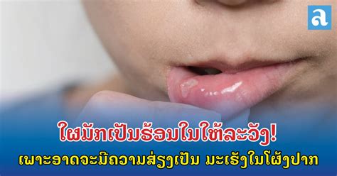 ມັກເປັນຮ້ອນໃນໃຫ້ລະວັງ ສ່ຽງເປັນມະເຮັງໃນໂຜ້ງປາກ ລາວໂພສຕ໌ Laopost