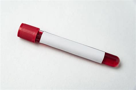 혈액 샘플과 텍스트에 대한 빈 라벨튜브 흰색 배경에 테스트 튜브 공간을 복사합니다 모형 0명에 대한 스톡 사진 및 기타 이미지 Istock