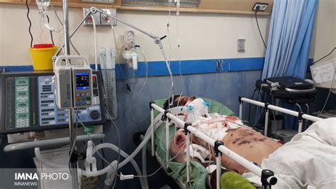 انفجار مواد محترقه در سگزی دستان جوان ۱۹ ساله را قطع کرد ایمنا