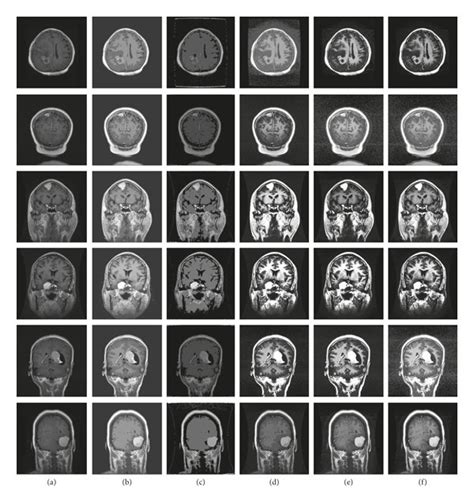 Segmentation Results Of Four Algorithms On Proprietary Dataset A