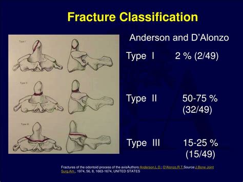 Ppt Upper Cervical Spine Fractures Powerpoint Presentation Free