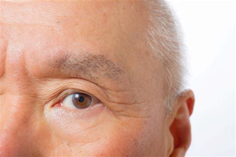 합정 남자울쎄라 중력을 거스르는 리프팅 네이버 블로그