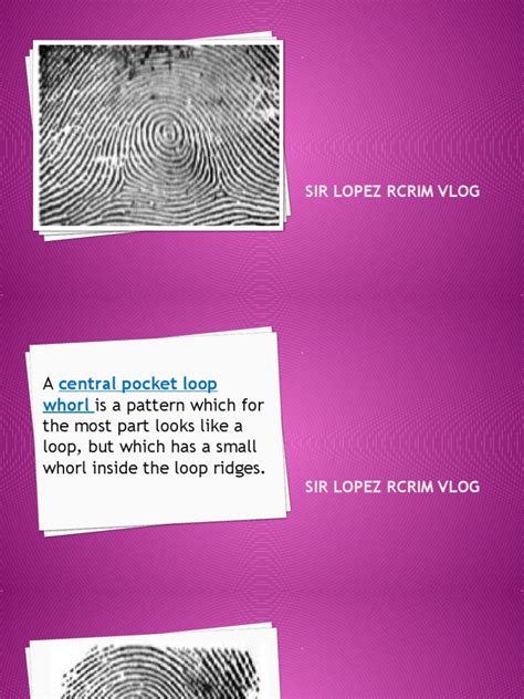 Central Pocket Loop Whorl Pdf