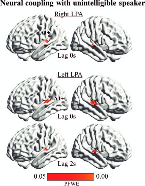 Listeners Neural Coupling To Speakers Lpa When Comprehension Failed Download Scientific
