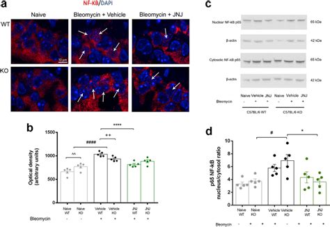 Evaluation Of Activation Of The P65 Nf κb Subunit In The Lungs A