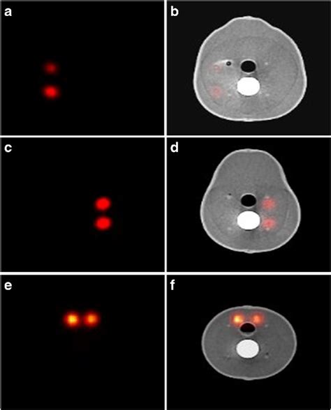 SPECT And SPECT CT Images In The Transverse Plane Representing The Download Scientific Diagram