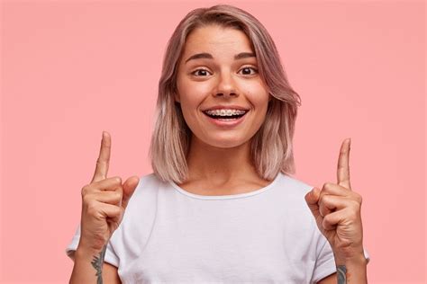 Brackets Autoligado ¿qué Son Doctores México