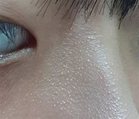 피부에 이런 오돌토돌한 거 뭔가요 지식in