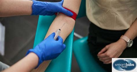 Rdw Blood Test Explained What You Need To Know