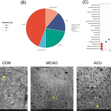 Scalp Acupuncture Alleviated Tissue Damage In Brains Of Rats With