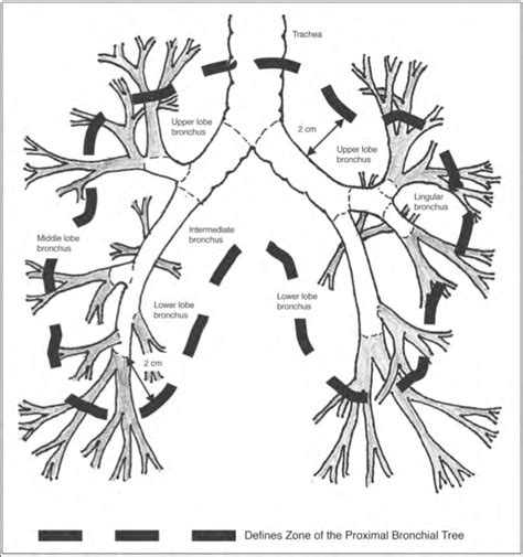 Définition De La Région Péri Hilaire Centrale Du Protocole Rtog 0236 [55] Download Scientific