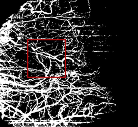 Illustration Of Binary Image Generated By Imagej Software For Analysis Download Scientific