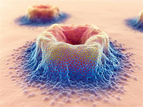 浆细胞骨髓瘤和多发性骨髓瘤有什么区别 浆细胞骨髓瘤 骨髓瘤 肿瘤疾病大全 癌症肿瘤科普知识 有来医生