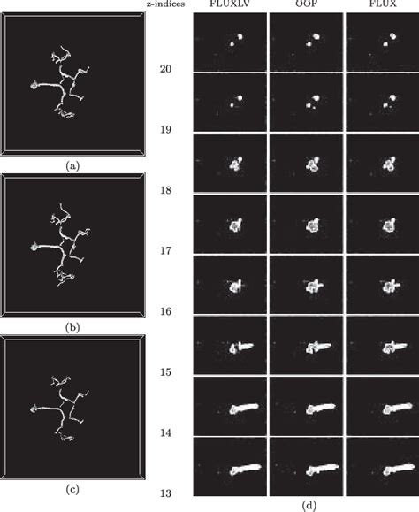 Figure 14 From Segmentation Of Intracranial Vessels And Aneurysms In Phase Contrast Magnetic