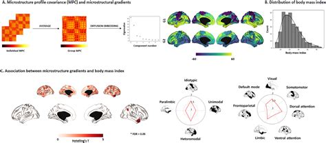 Posterior Cortical Atrophy