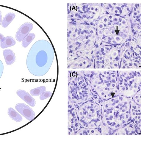 A The Normal Descent Of The Testes Illustration Of Key Elements