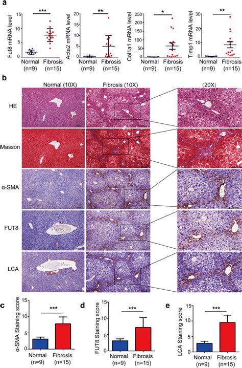 Fut8 Is Up Regulated In Mouse Liver Fibrosis Model The C57bl6j Mice