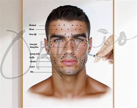 Botox Injection Points On Muscle Anatomy Botox And Filler Injector