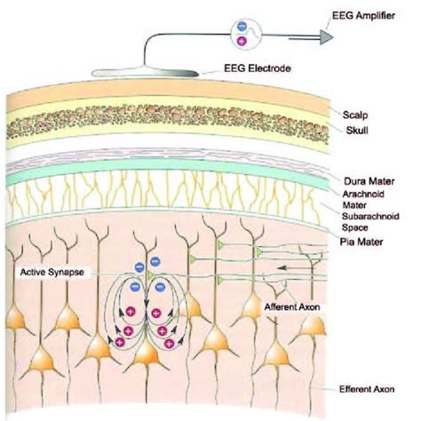 Sloreta Model Front And Lateral Views Of The Brain During A Download Scientific Diagram