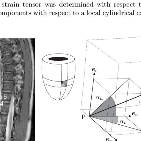 Left Long Axis Mr Slice Demonstrating The Positions Of The Five