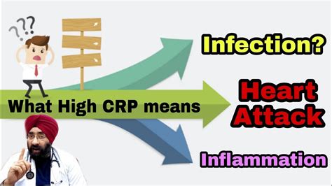 C Reactive Protein Crp Symptoms Lab Test Information 45 Off