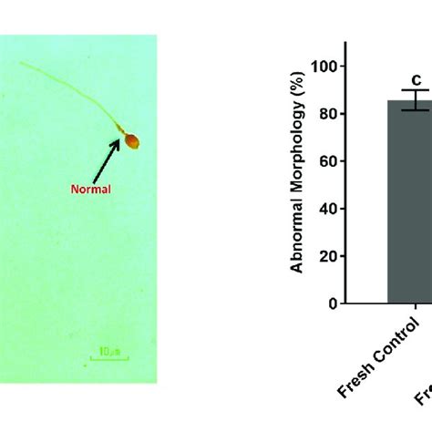 Sperm Morphology Normal And Abnormal Morphology Of Sperm As Indicated