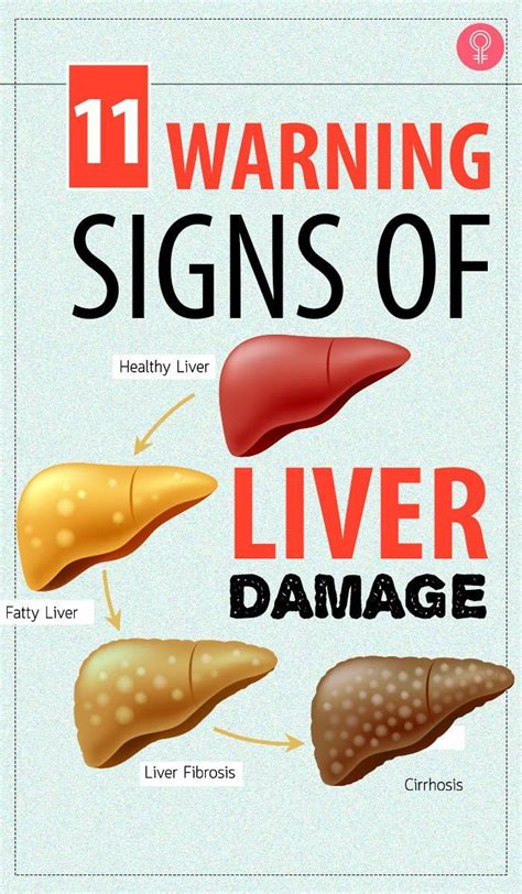 Liver Health Artofit