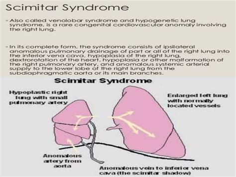 Presentation1 Pptx Radiological Imaging Of Congenital Abnormalities Of