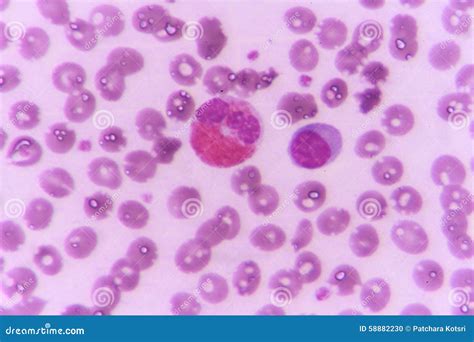 What Are Eosinophils Definition Low High Reference