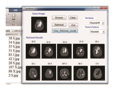 Retrieval Results Of Wavelet Transform Algorithm Combined With Download Scientific Diagram