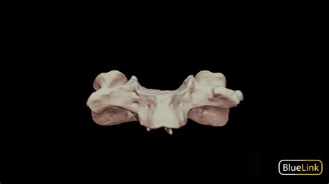 Cervical Vertebrae C5 Labeled 3d Model By Bluelink Anatomy Bluelinkanatomy [ba09647