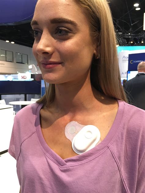 Movement Toward Simpler Wearable Cardiac Monitoring Health Device Cardiac Patient Engagement
