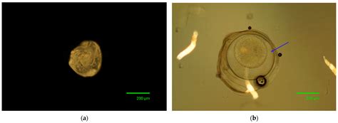 Microfluidic Synthesis And Properties Of Thermoresponsive Hydrogel Core Shell Particles