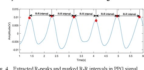 Figure 7 From Heart Rate And Heart Rate Variability As Classification Features For Mental