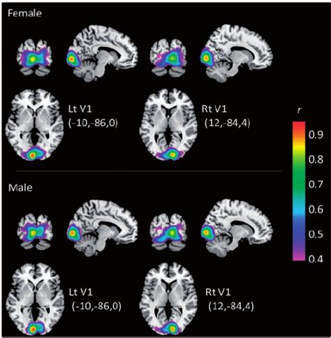 Functional Connectivity From V ROIs To Other Visual Areas In Each Sex Download Scientific